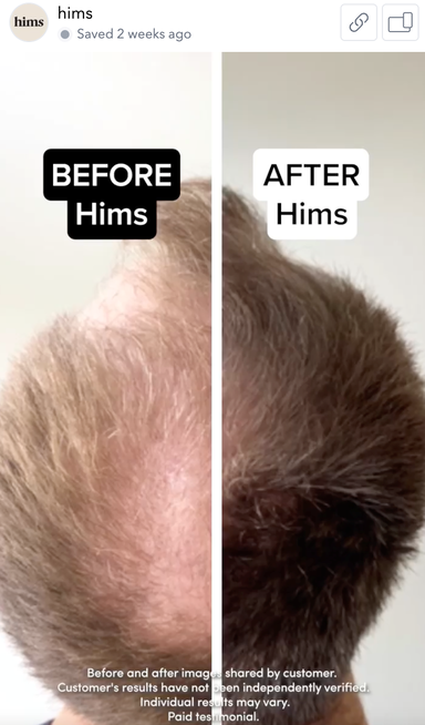 Before & After Hair Loss Ad | SwipeFile